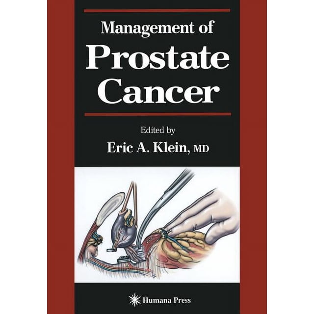 Current Clinical Urology Management of Prostate Cancer, (Paperback ...