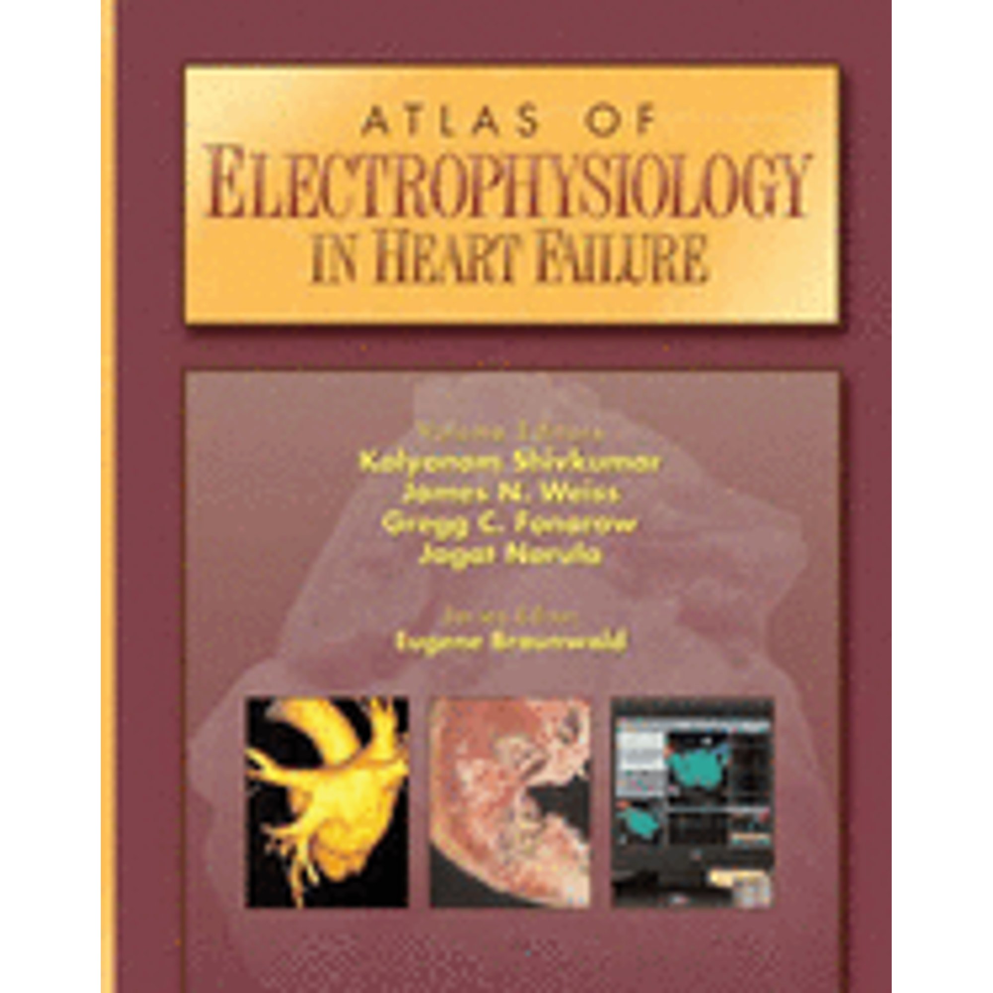 Pre-Owned Atlas of Electrophysiology in Heart Failure Current Medicine ...