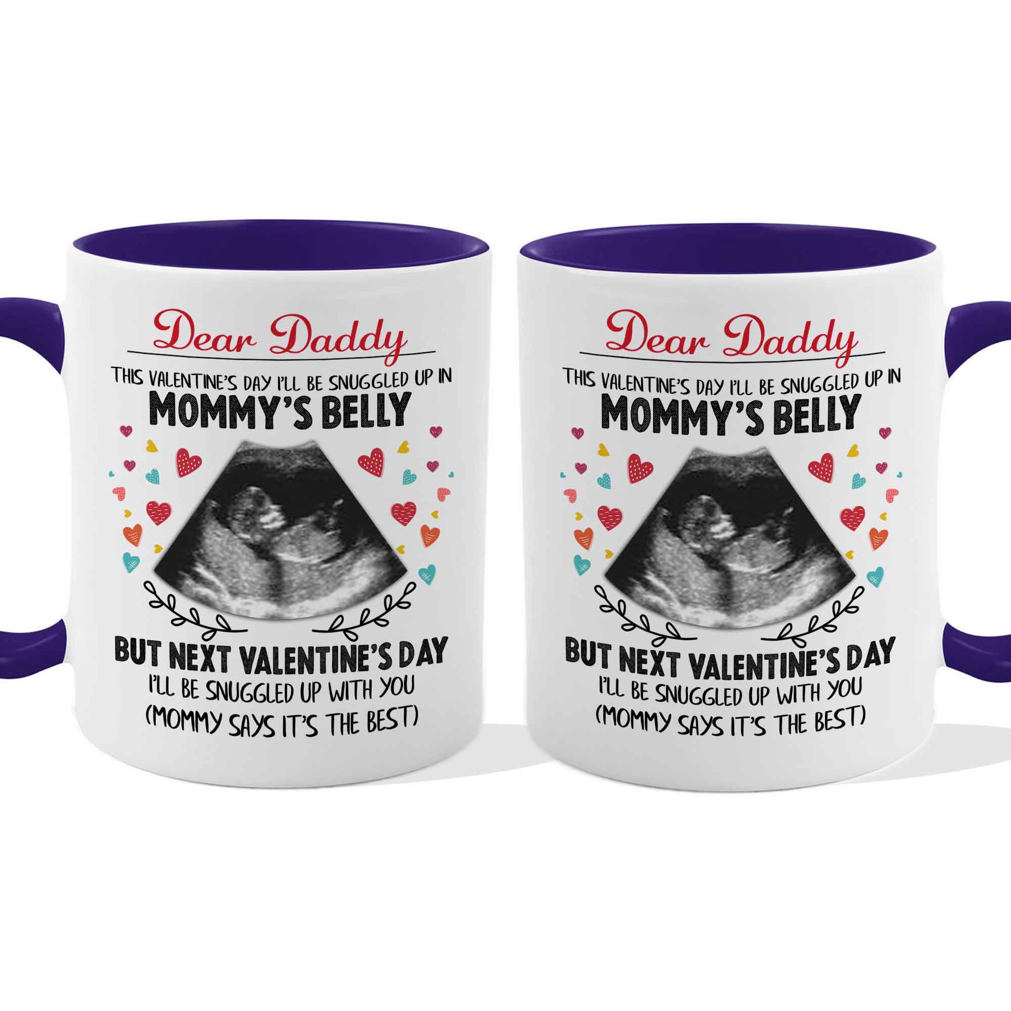 Customizaholic Personalized Pregnancy Announcement Mug - Ultrasound ...