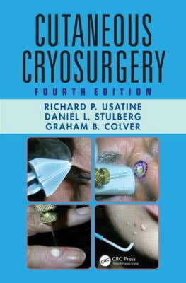 Pre-Owned Cutaneous Cryosurgery (Hardcover) 1482214733 9781482214734 ...