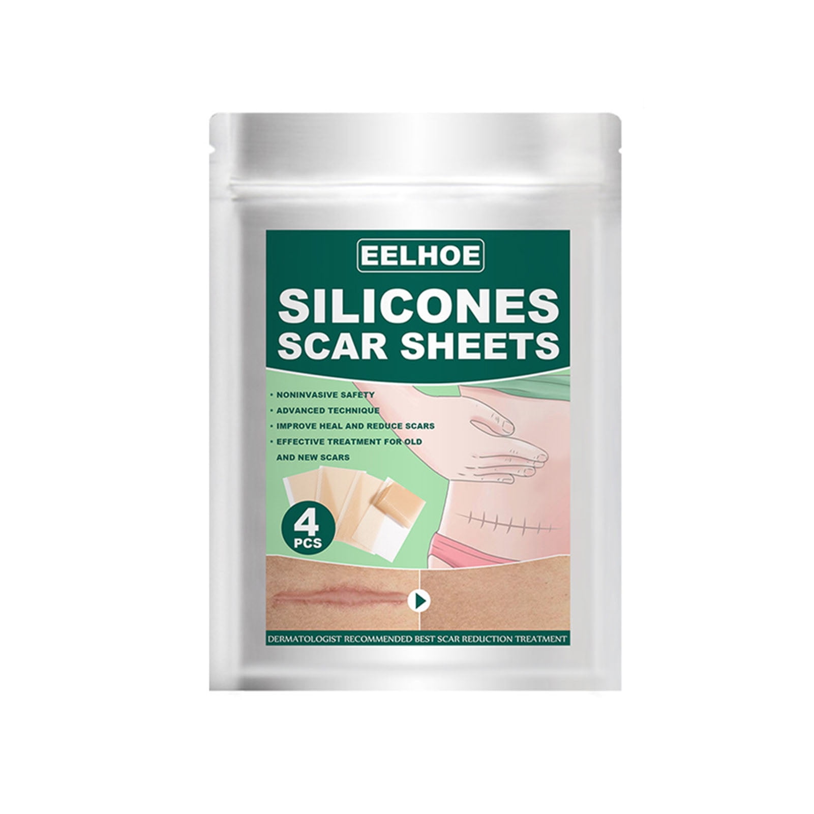 Cuteam Scar Sticker,4Pcs/Bag Scar Sticker Soften Stratum Corneum ...