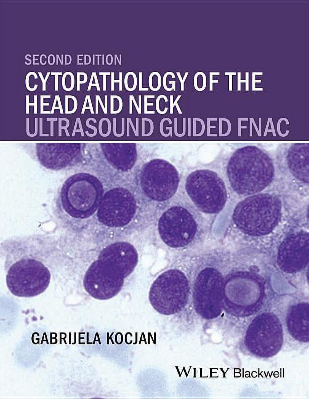 Cytopathology of the Head and Neck: Ultrasound Guided Fnac (Hardcover ...