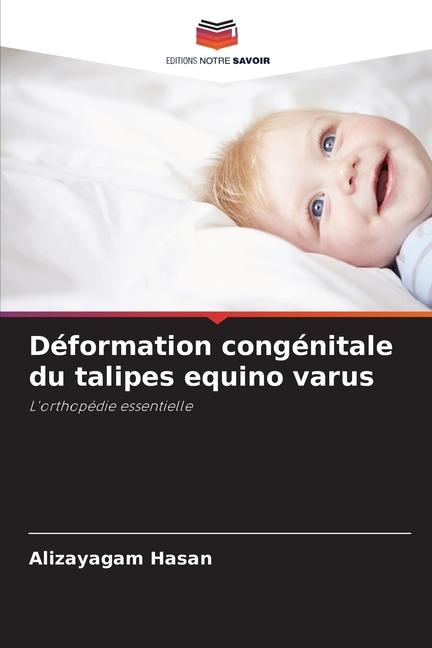 DÃ©formation congÃ©nitale du talipes equino varus, (Paperback ...