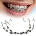 Dénturés-Colored Braces Educational Model, Removable Teeth Set ...
