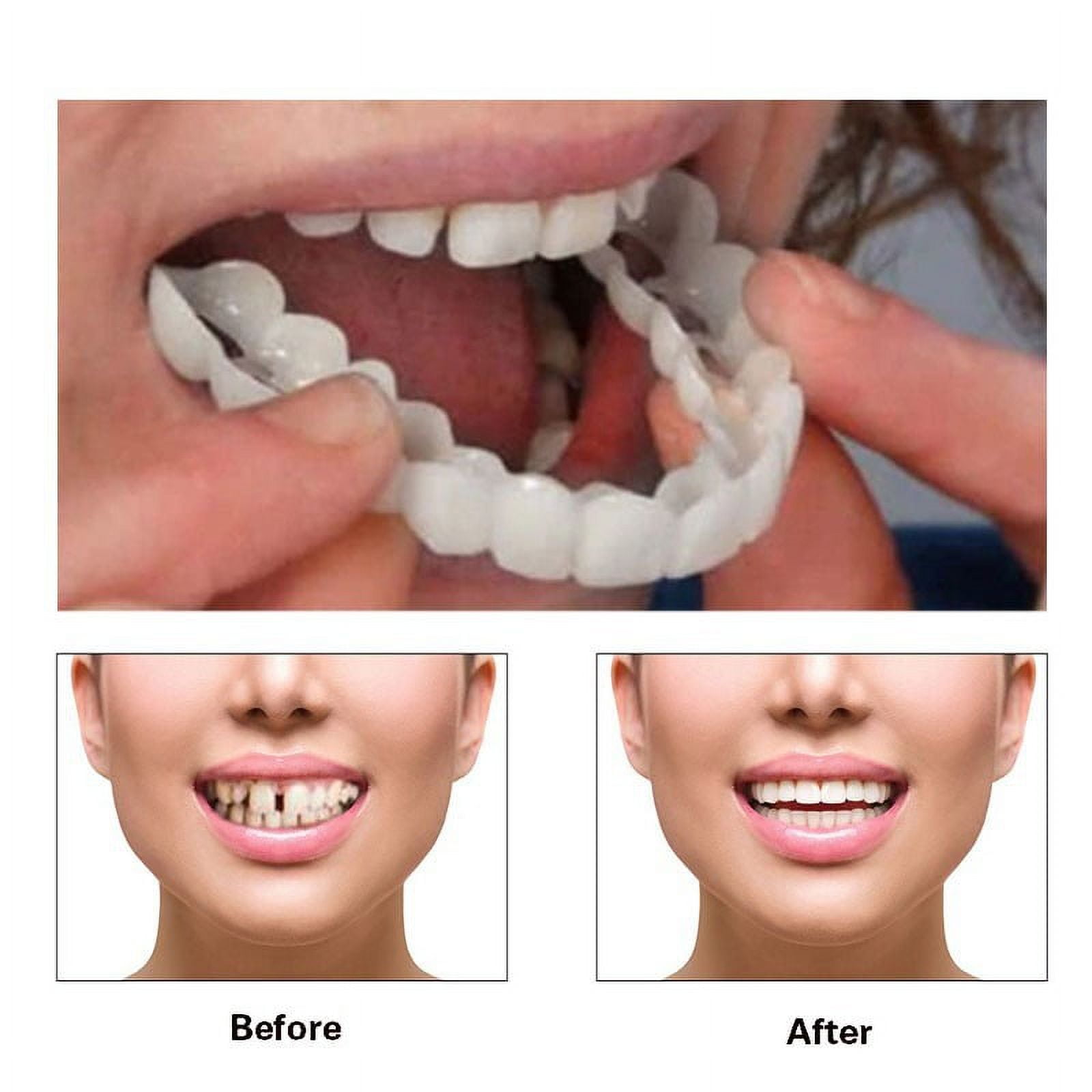 DDWD snap on smile upper and lower teeth simulation braces whitening ...