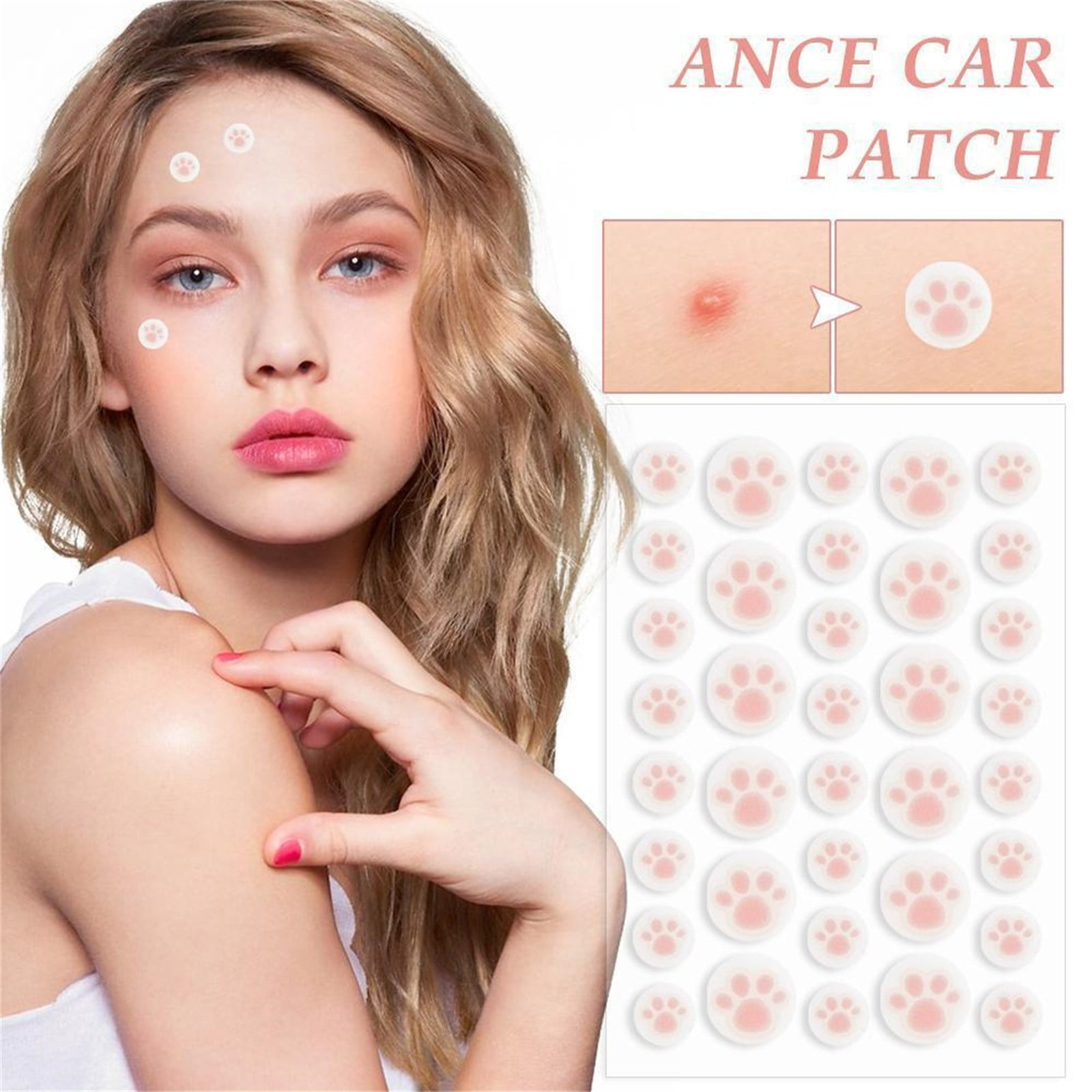 DEJUPE Acne Patch Large Capacity Pimple Patches, Cat Scratch Cute Zit Covers Hydrocolloid Acne ...