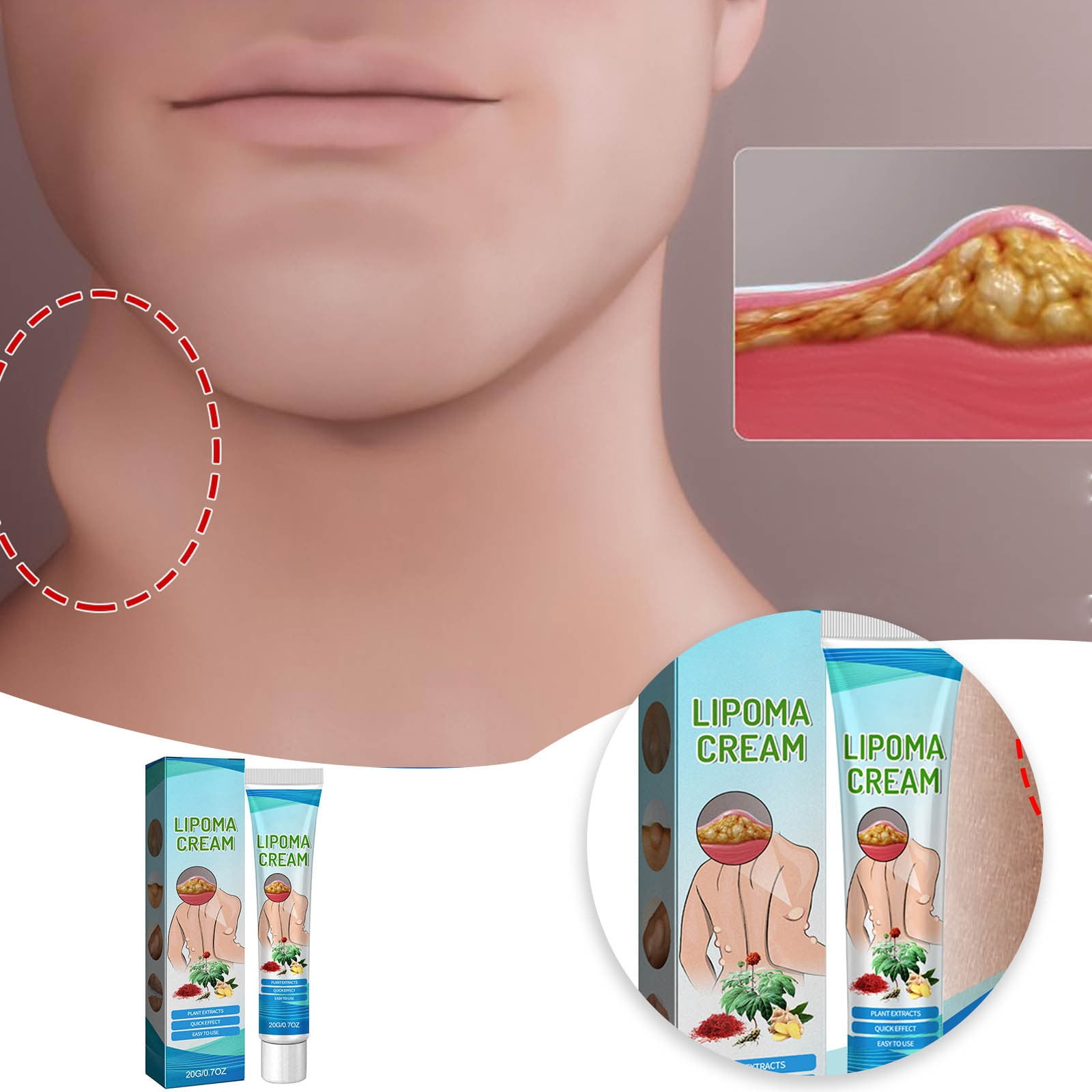 DFC Fatty Knot Fatty Knot Subcutaneous Lumps Dredging And Dispersing Knot Body Care - Walmart.com