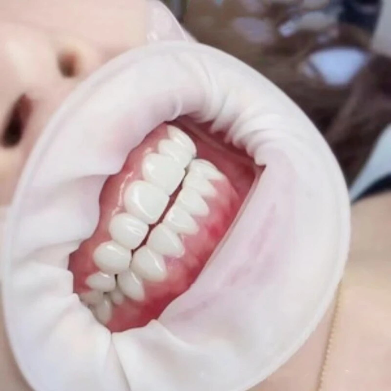 DFUDIEJ 10Pcs Dental Disposable Rubber Sterile Mouth Opener CYW036 ...