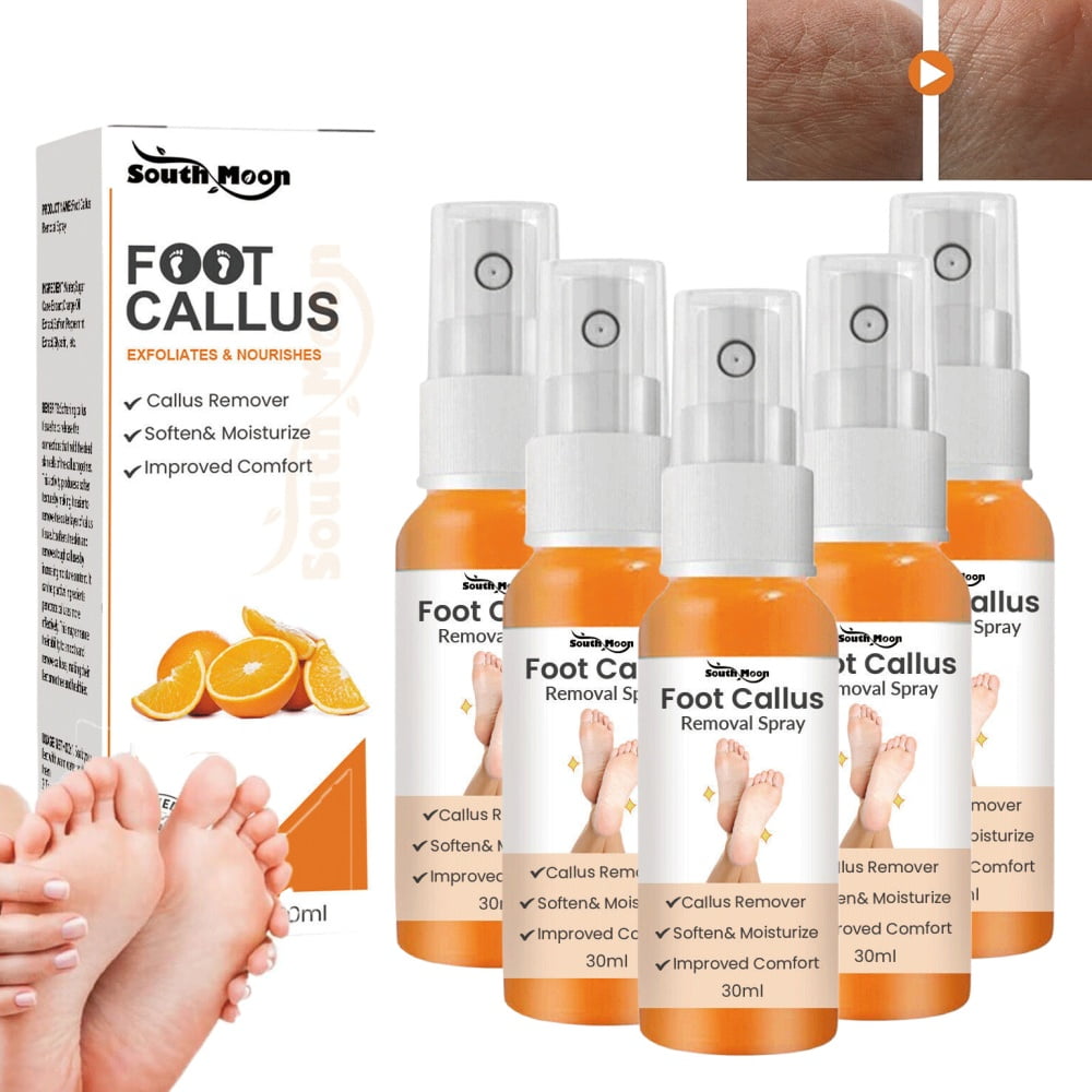DGSLMY Foot Peeling Spray 30ml for Remove Dead Skin, for Cracked Rough ...
