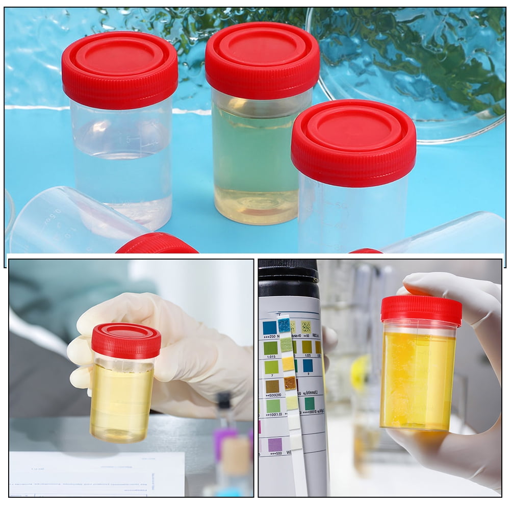 DIAEDGE 100pcs Urine Specimen Cups Urine Sample Collection Cups Plastic ...