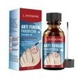 DLHP 10ml Ash Finger Shell Liquid Repair Warm And Warm Water - Walmart.com