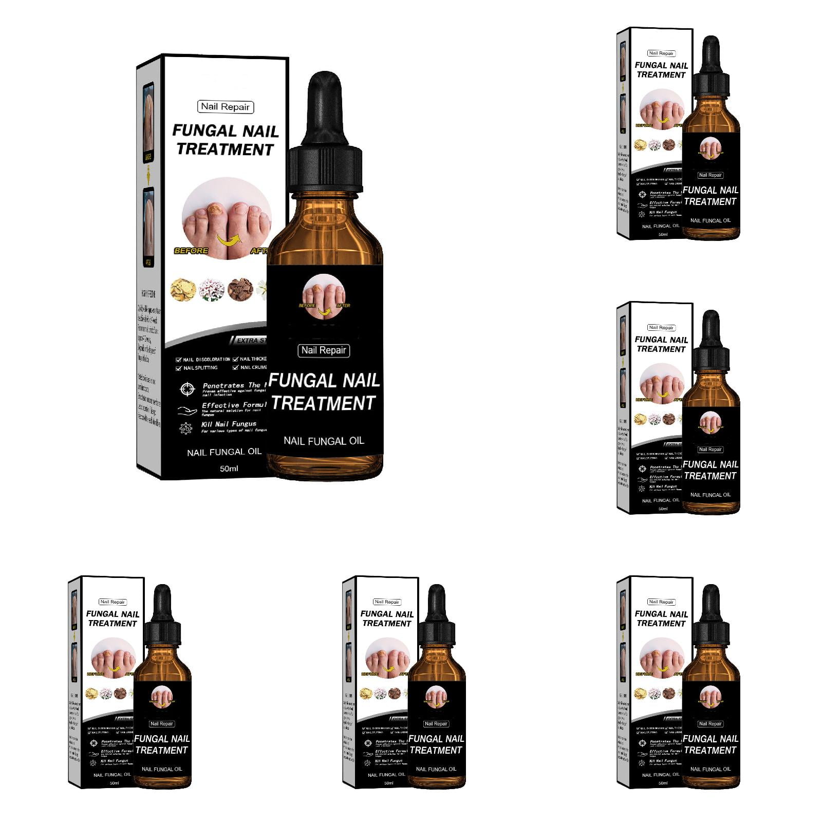 DONGGWTS Nail Lotion Drops Thickening And Nails Removing Gray Nails ...