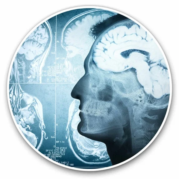 DOPASTICKER Brain X-Ray Medical Scan Doctor Cool Gift Decorative Laptop ...