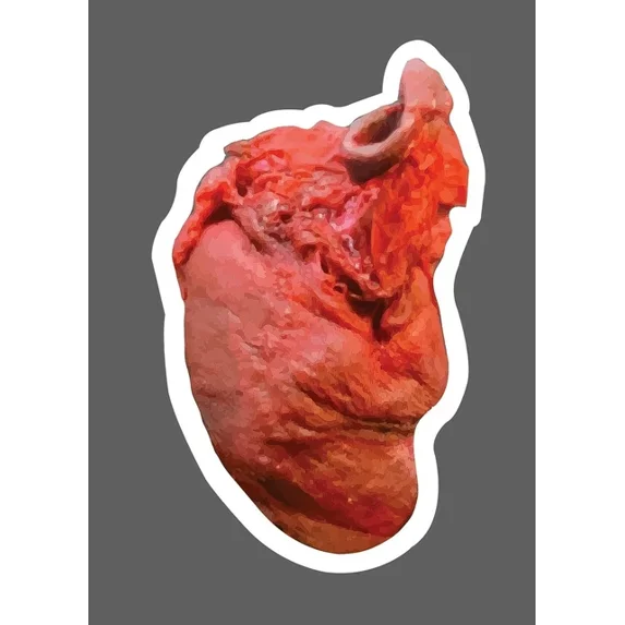 DOPASTICKER Heart Sticker Realistic Muscle Medical Health Sticker Phone ...