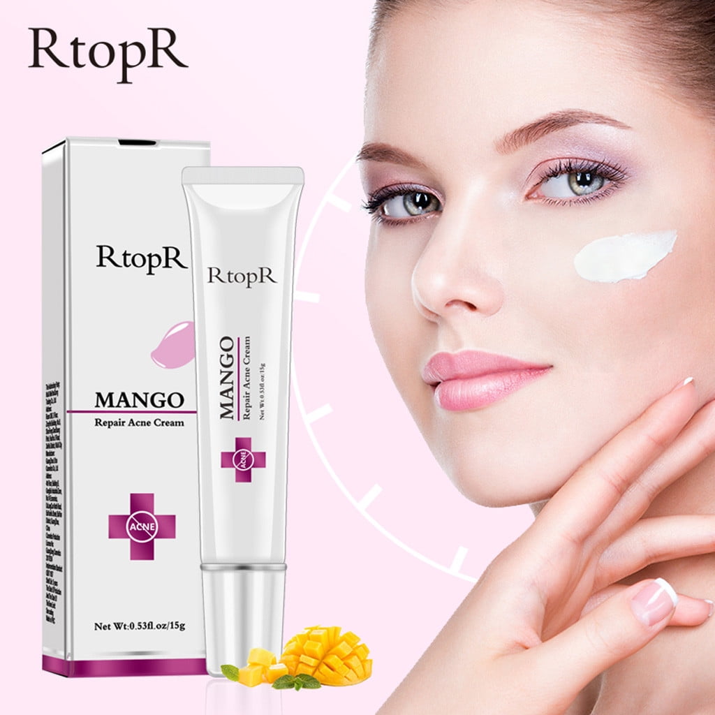 DUAONETS Mango Repair Acne Cream Extract Acne Removal Scars Marks ...