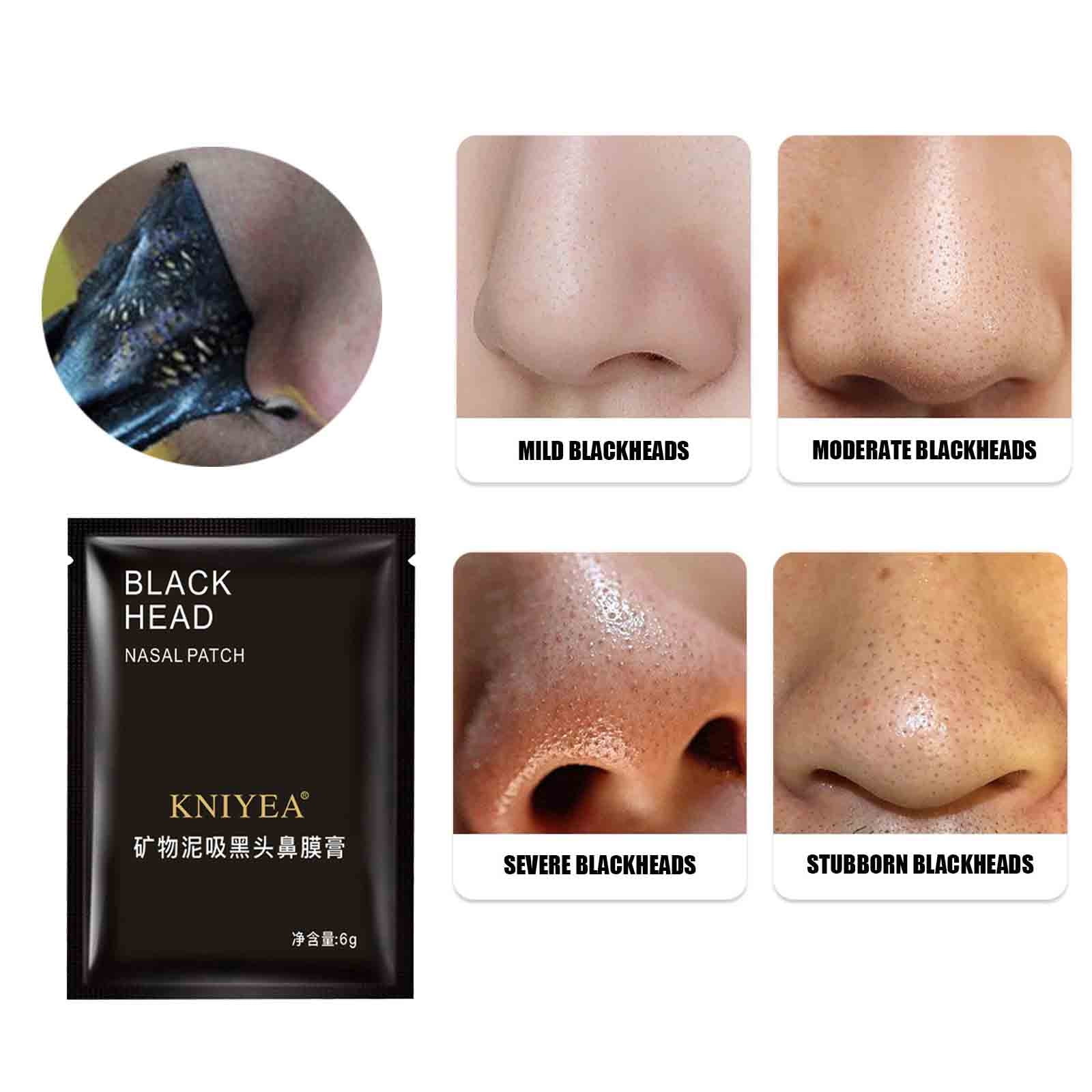 DUMUIELD Deals Charcoal Face Mask Blackhead Remover Mask, Blackhead ...