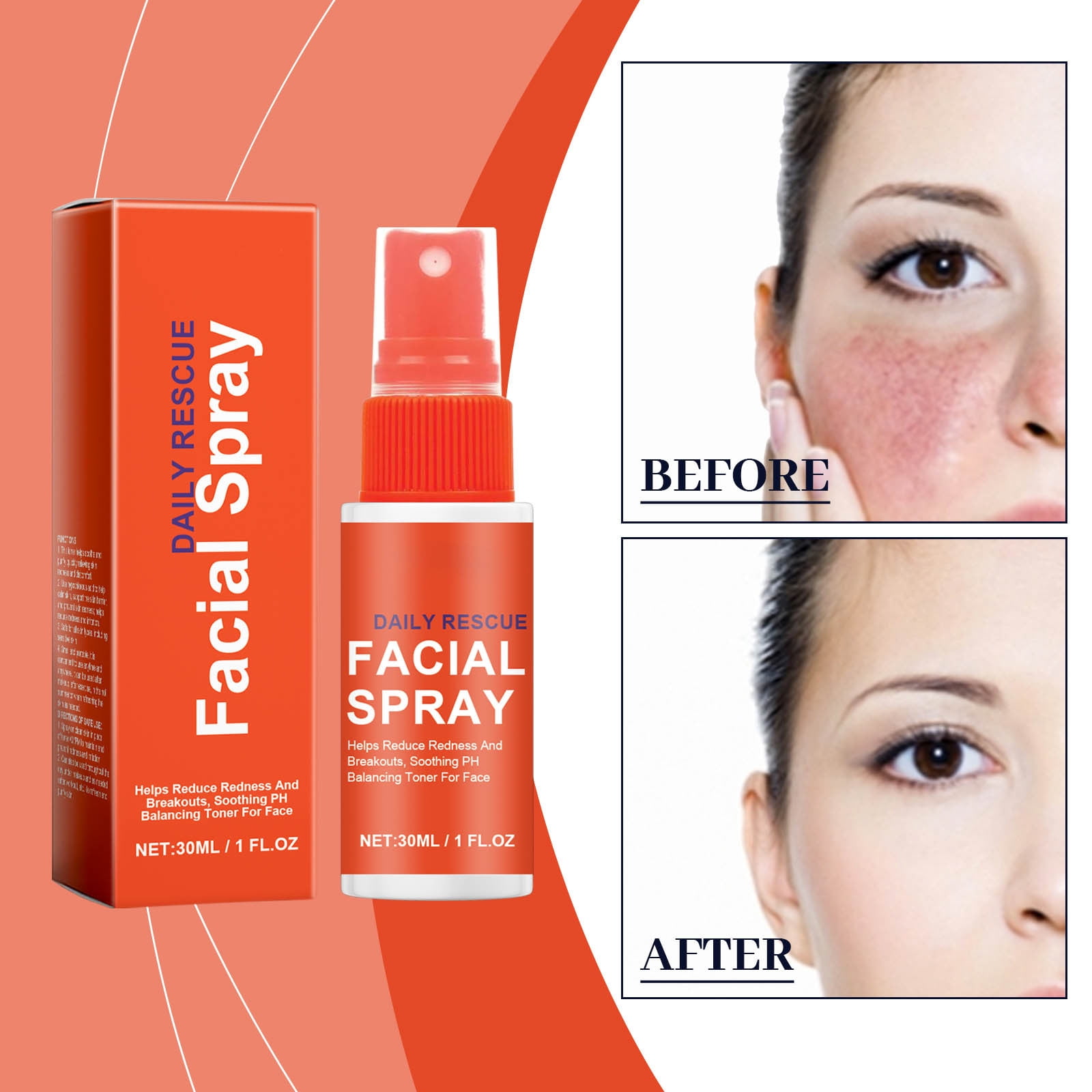 Daily Facial Spray For Sensitive Skin Hypochlorous Spray Helps Reduce ...