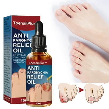 Dr. Scholl's Ingrown Toenail Pain Reliever kit- OTC Foot Care Treatment ...