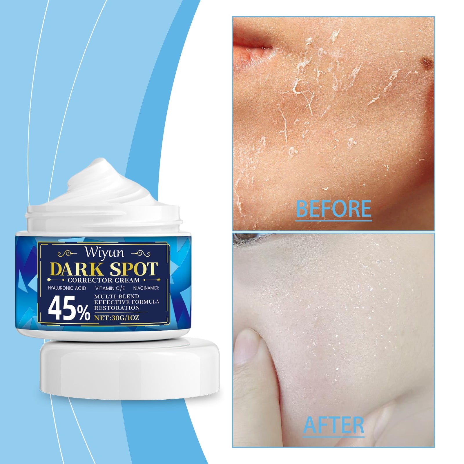 Dark Remover For And Body: Dark Corrector Freckle Sun Age Remover ...