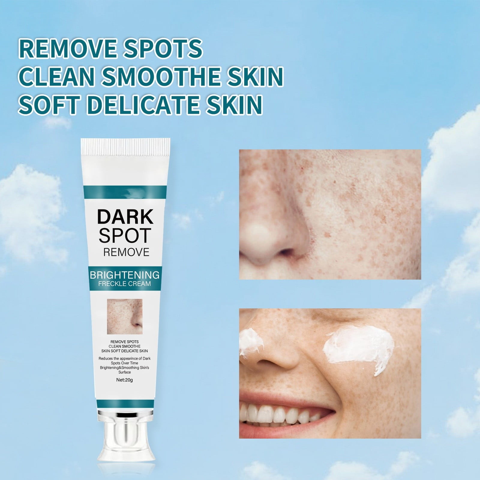 Dark Remover | & | Pimple Marks | | Uneven Skin Tone | & Removal ...