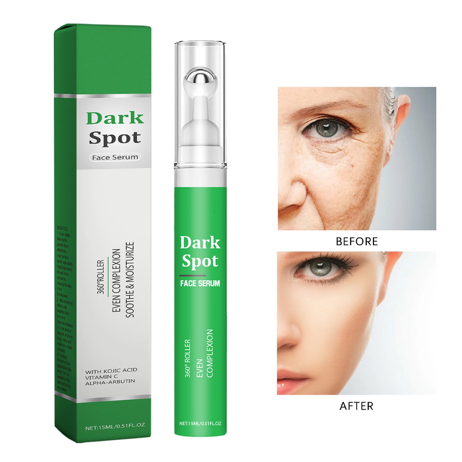 Dark Speckle Remover For Face With Roller: Dark Speckle Corrector For ...