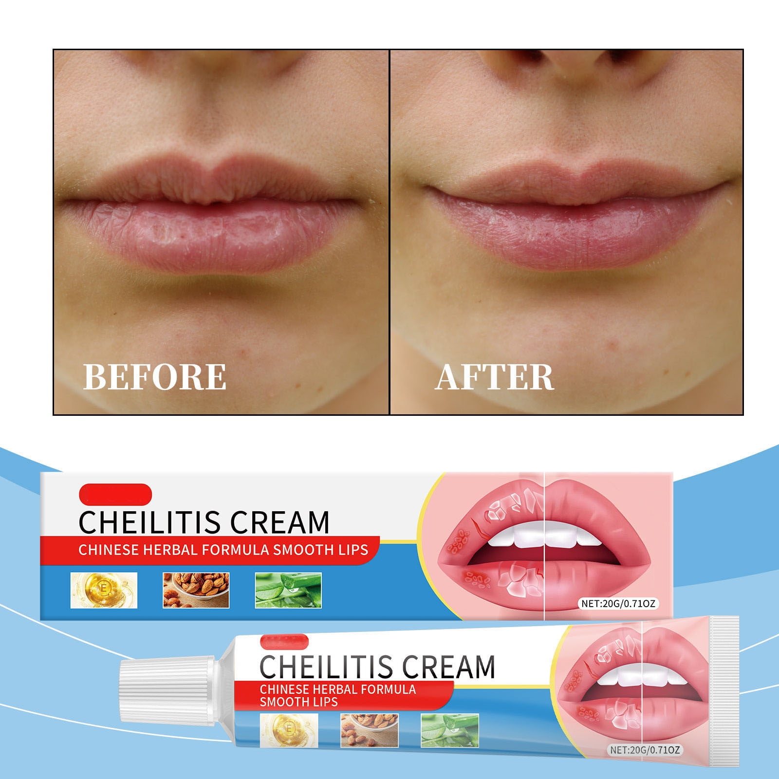 Deals Clearance Under 5 Lip Cream for Cheilitis, Cheilitis Lip Treatment Cream, Hydrating Lip ...