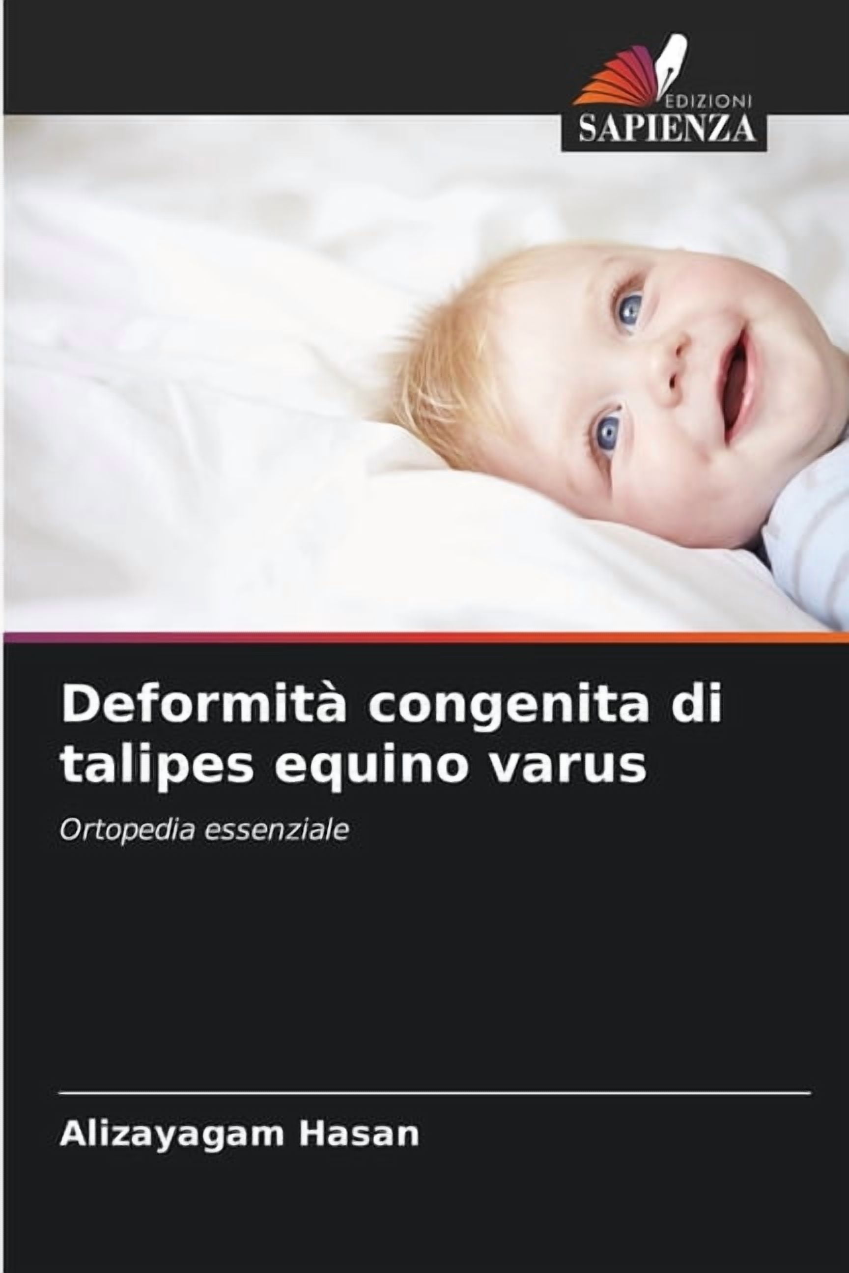 DeformitÃ congenita di talipes equino varus, (Paperback) - Walmart.com