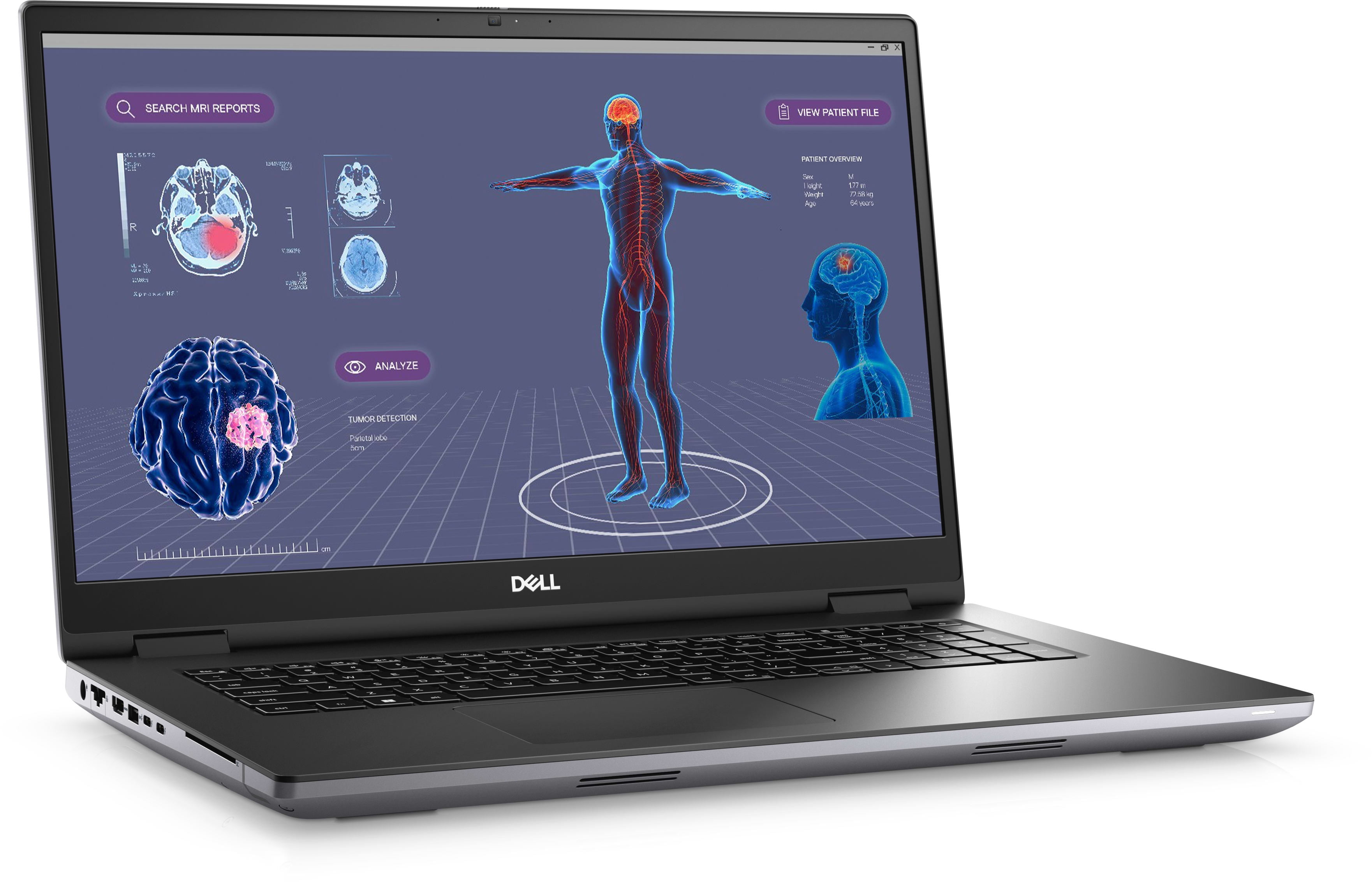 Dell Precision 7780 Workstation Laptop (2023) | 17" 1920x1080 FHD ...