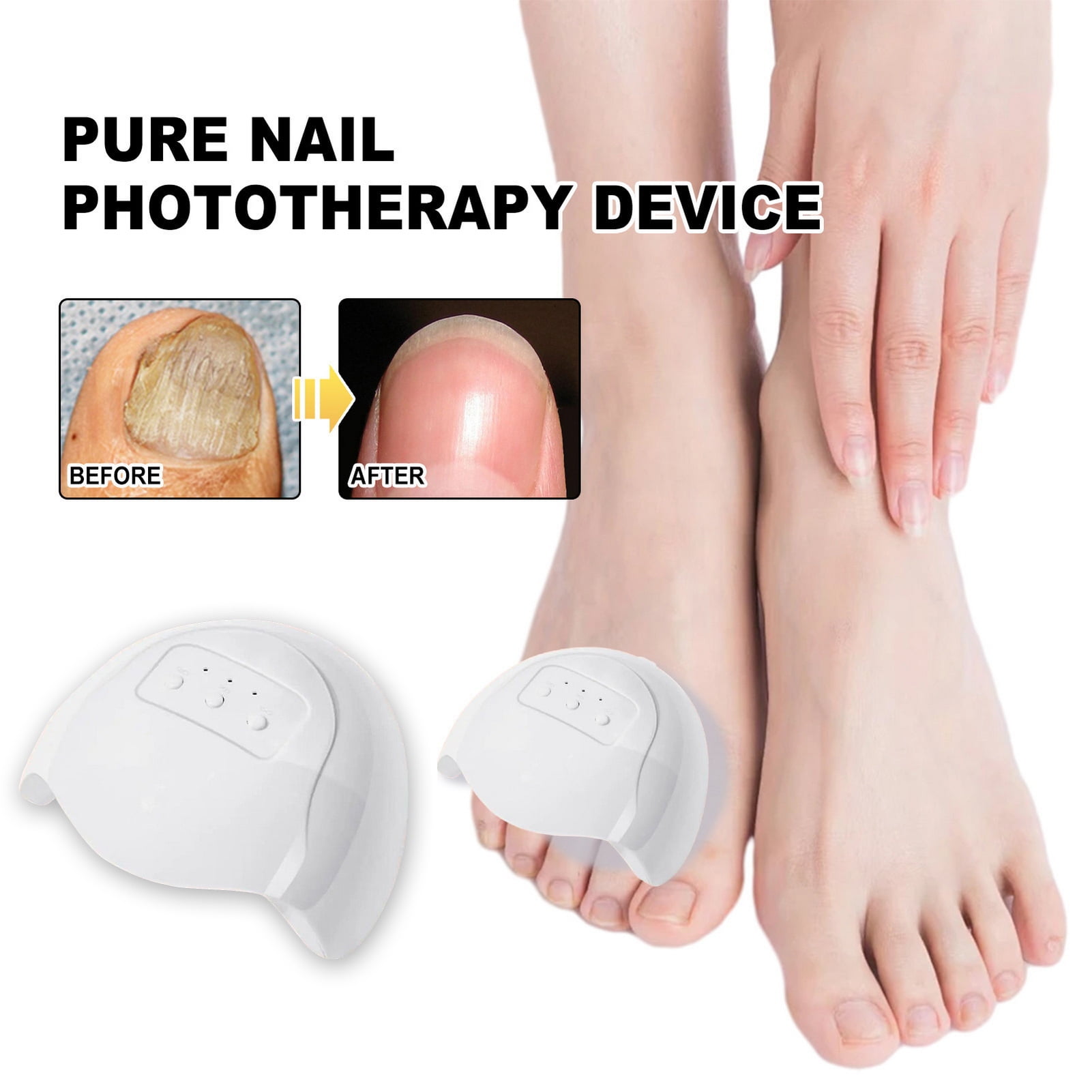 Demete Nail Care Device for Paronychia Infrared Treatment Growth ...