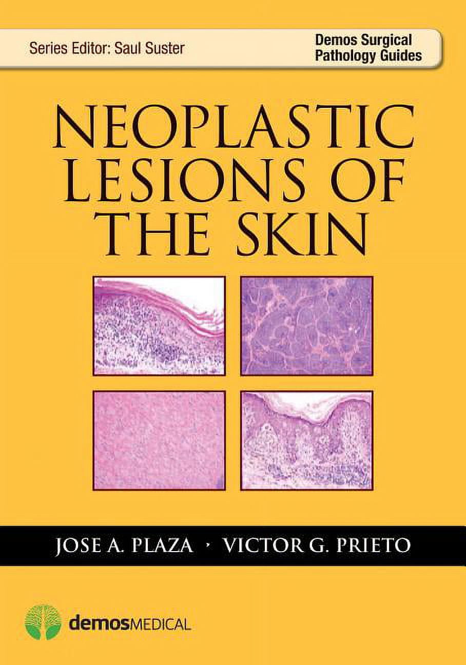 Neoplastic Lesions of the Skin (Demos Surgical Pathology Guides ...