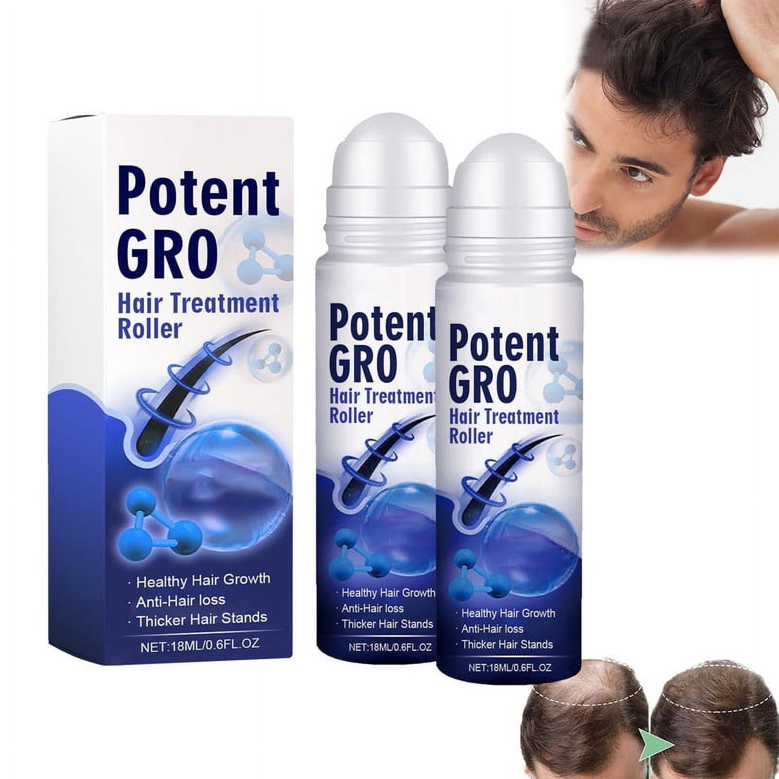 Dense Hair Origin Roller, Roll-On Hair Treatment, Roller Thick Hair ...