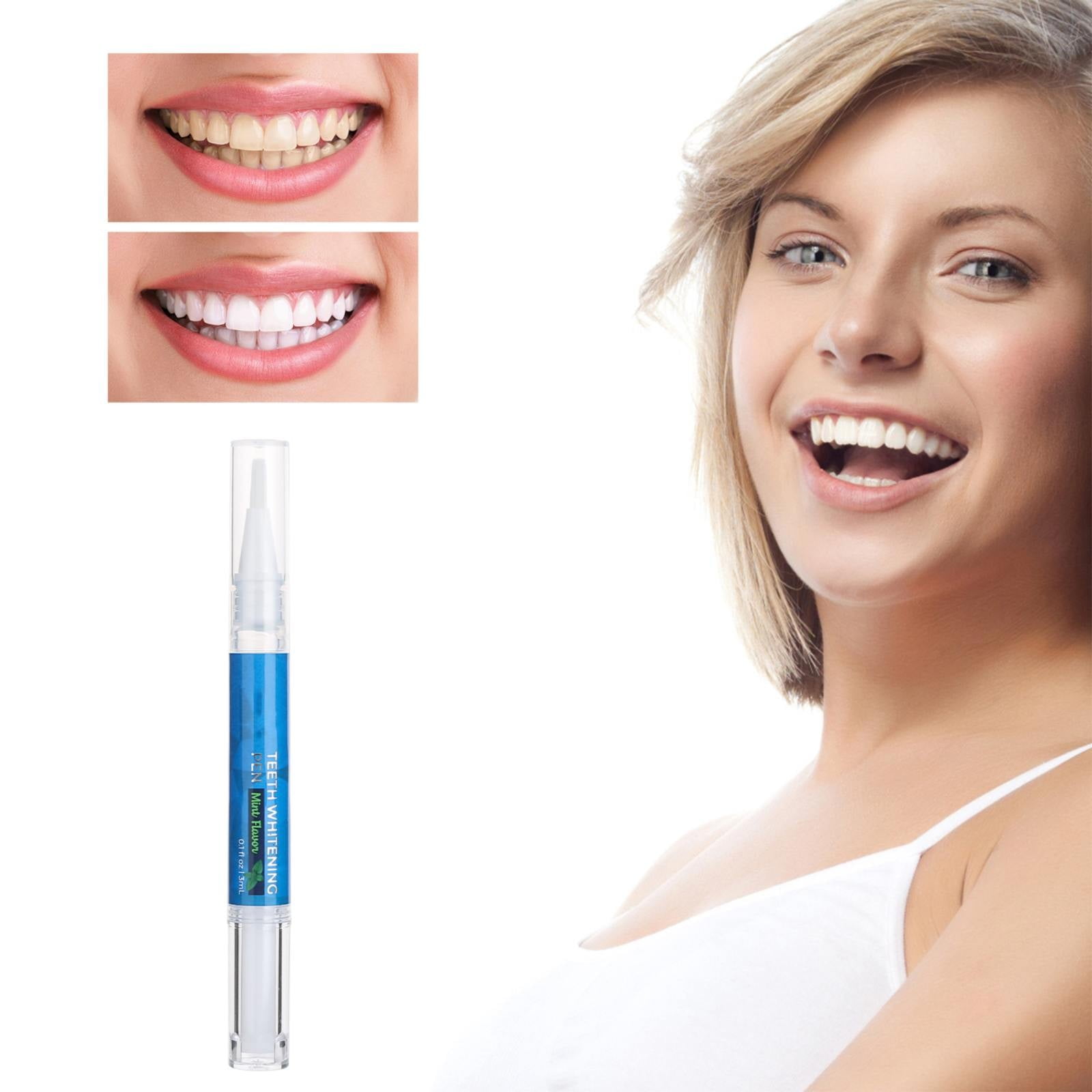 Dental Care Agents Tooth Care Teeth Pen Gel Tooth White Gel for A ...