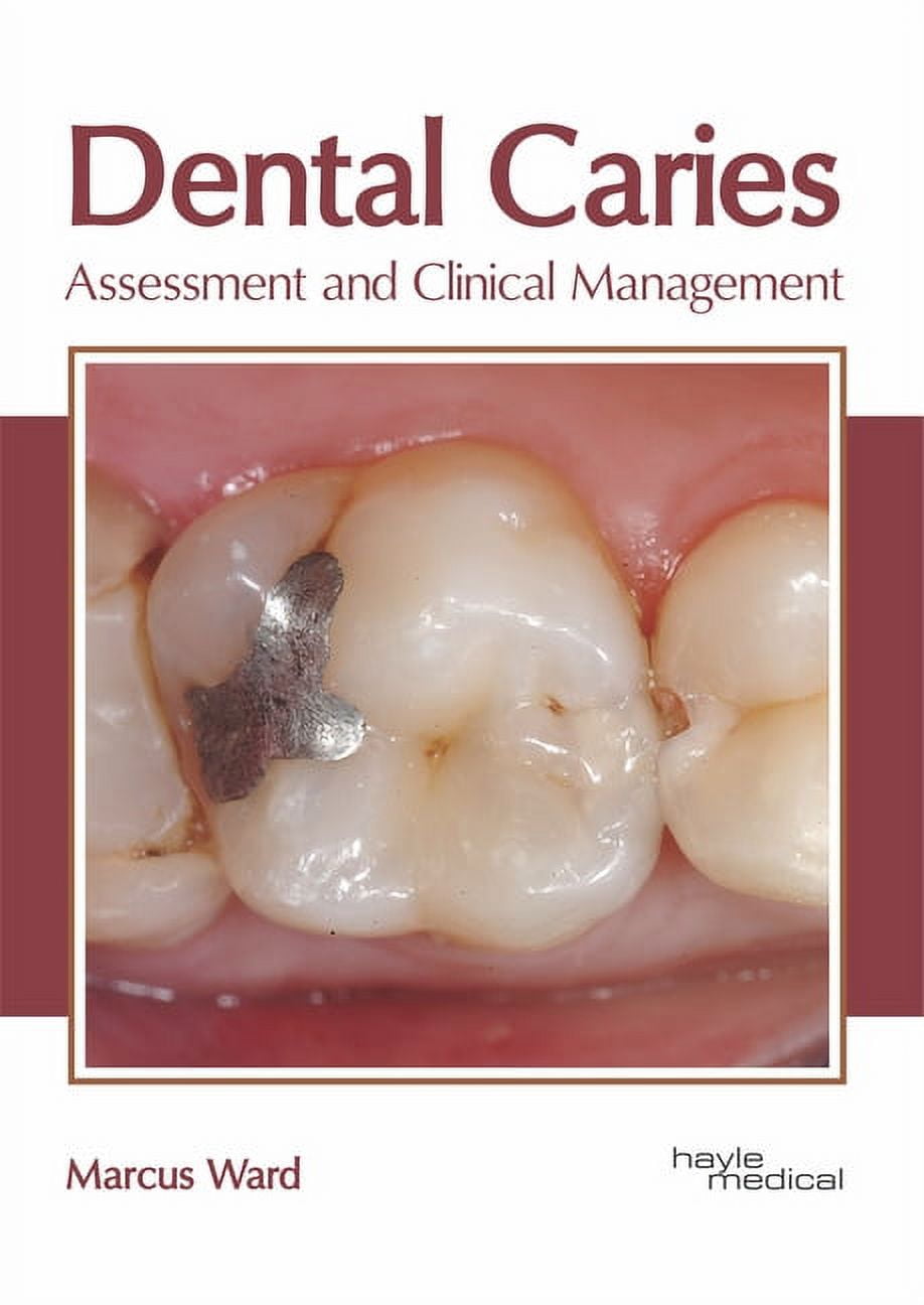 Dental Caries: Assessment and Clinical Management, (Hardcover ...
