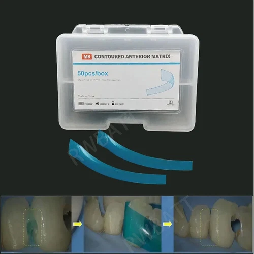 Dental Contoured Anterior Matrix Bands Polyester Anterior Strips ...