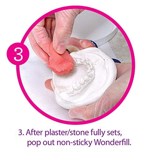 Dental Creations Wonderfill Tongue and Void Filler – Pre-Mixed Dental ...