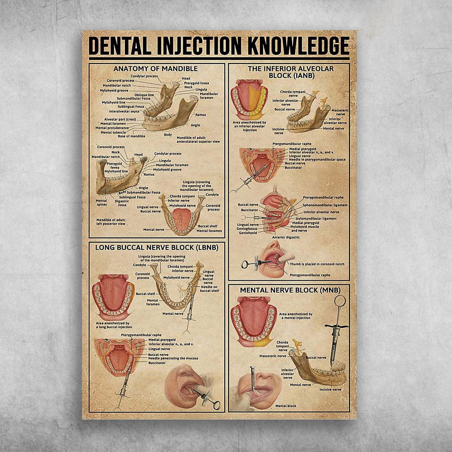 Dental Injection Knowledge - Anatomy Of Mandible, The Inferior Alveolar ...