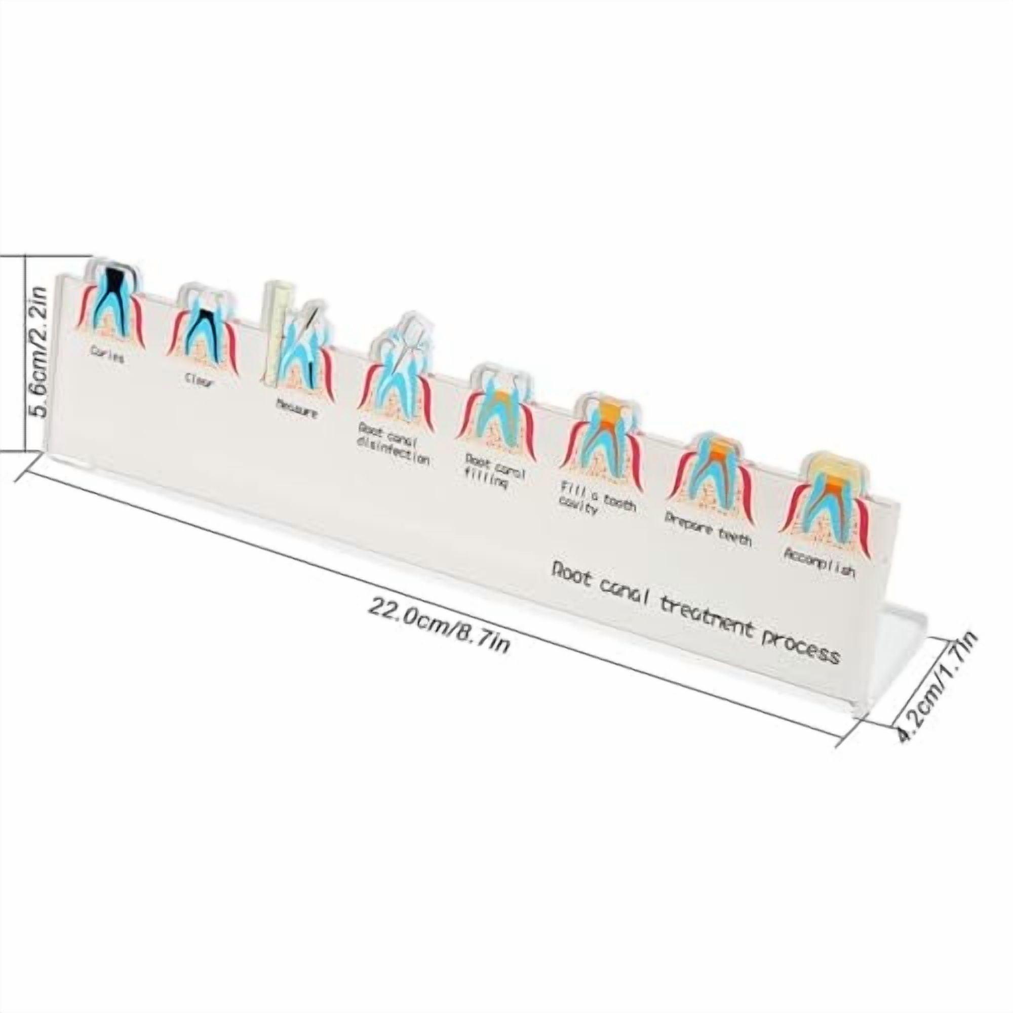 Dental Root Canal Treatment Flowchart Stand, Periodontal Disease ...