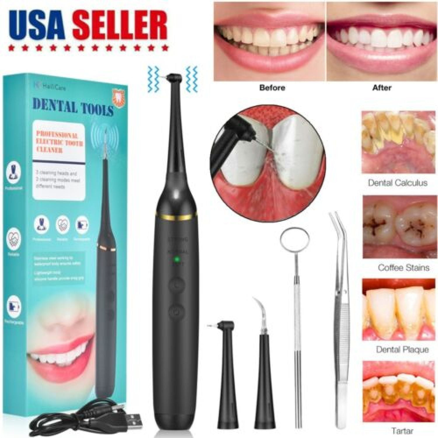 Dental Scaler Electric Sonic Tartar Calculus Plaque Remover Tooth ...