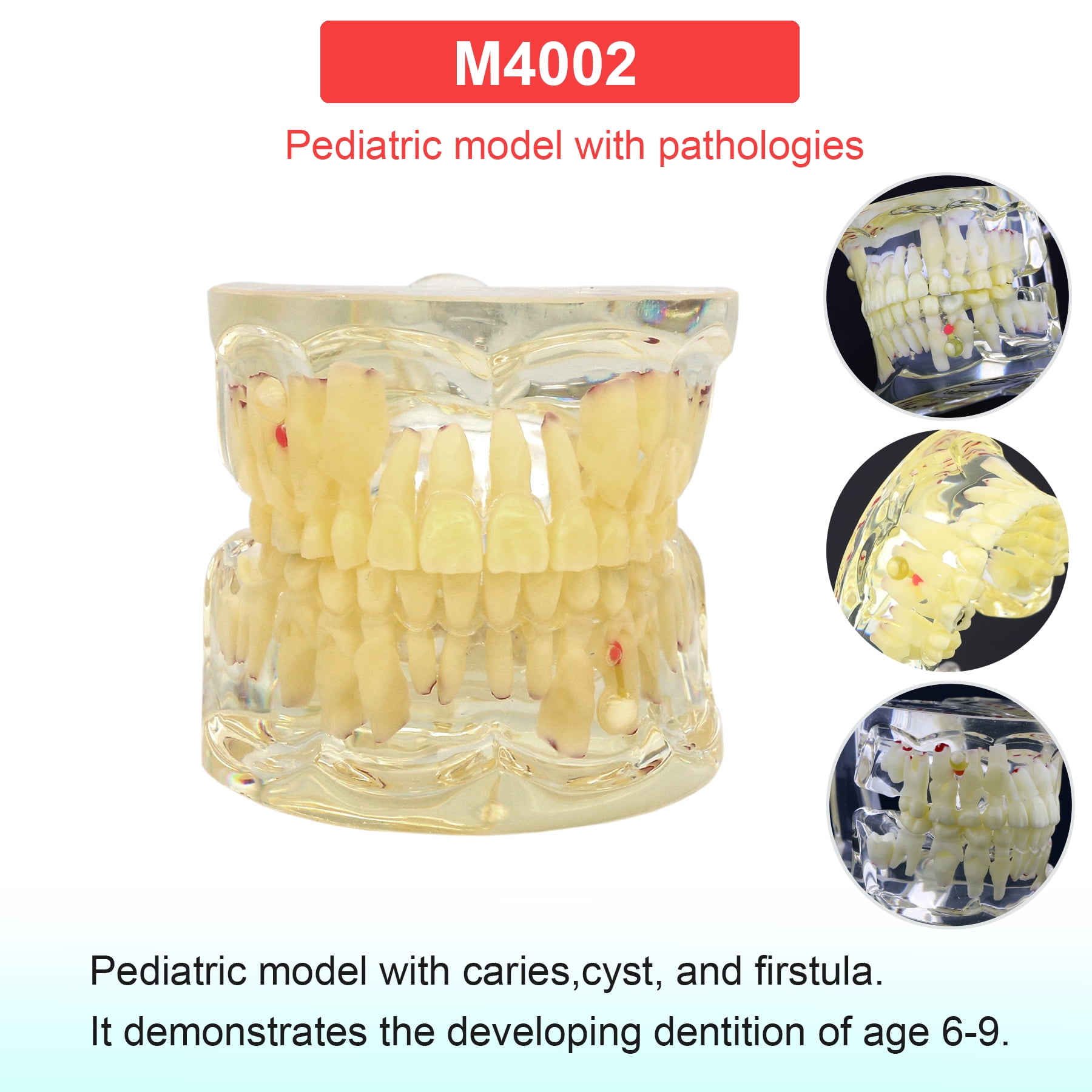 Dental Teeth Model Dental Teaching Models Implant Model Removable ...