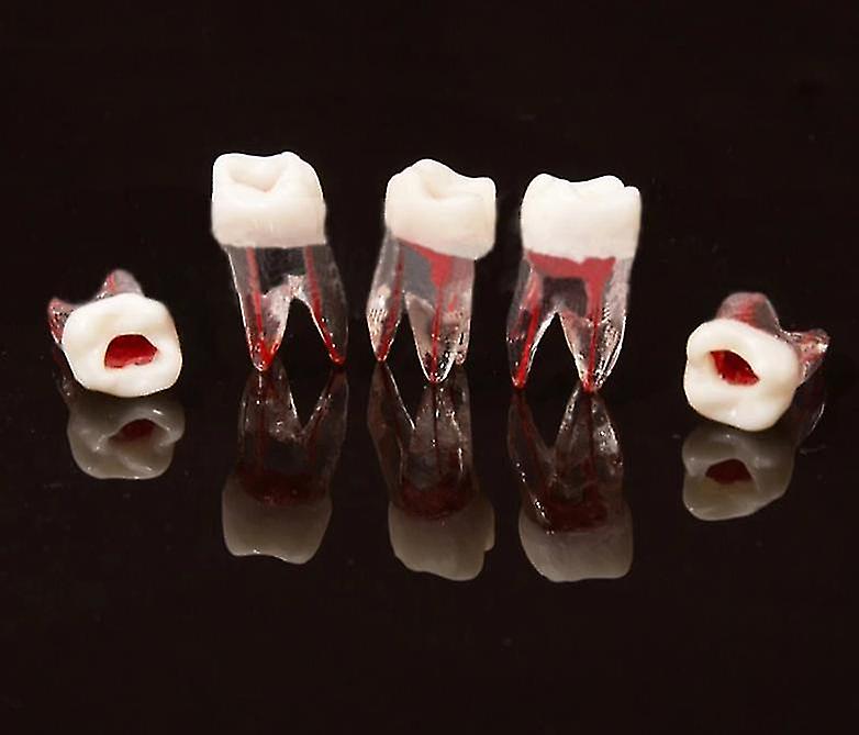 Dental Tooth Root Canal Model For Rct Practice Dentistry Lab Material ...