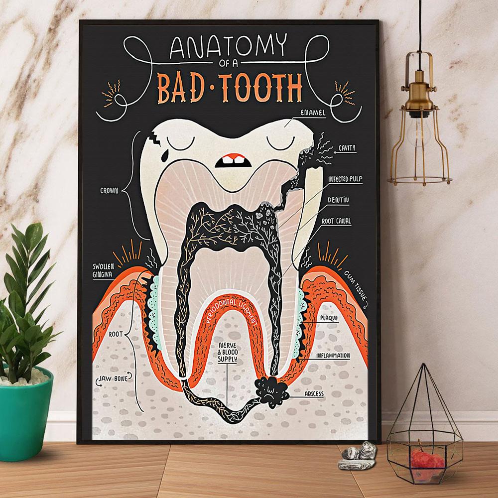 Dentist Anatomy Of A Bad Tooth Paper Poster No Frame Matte Wall Art ...
