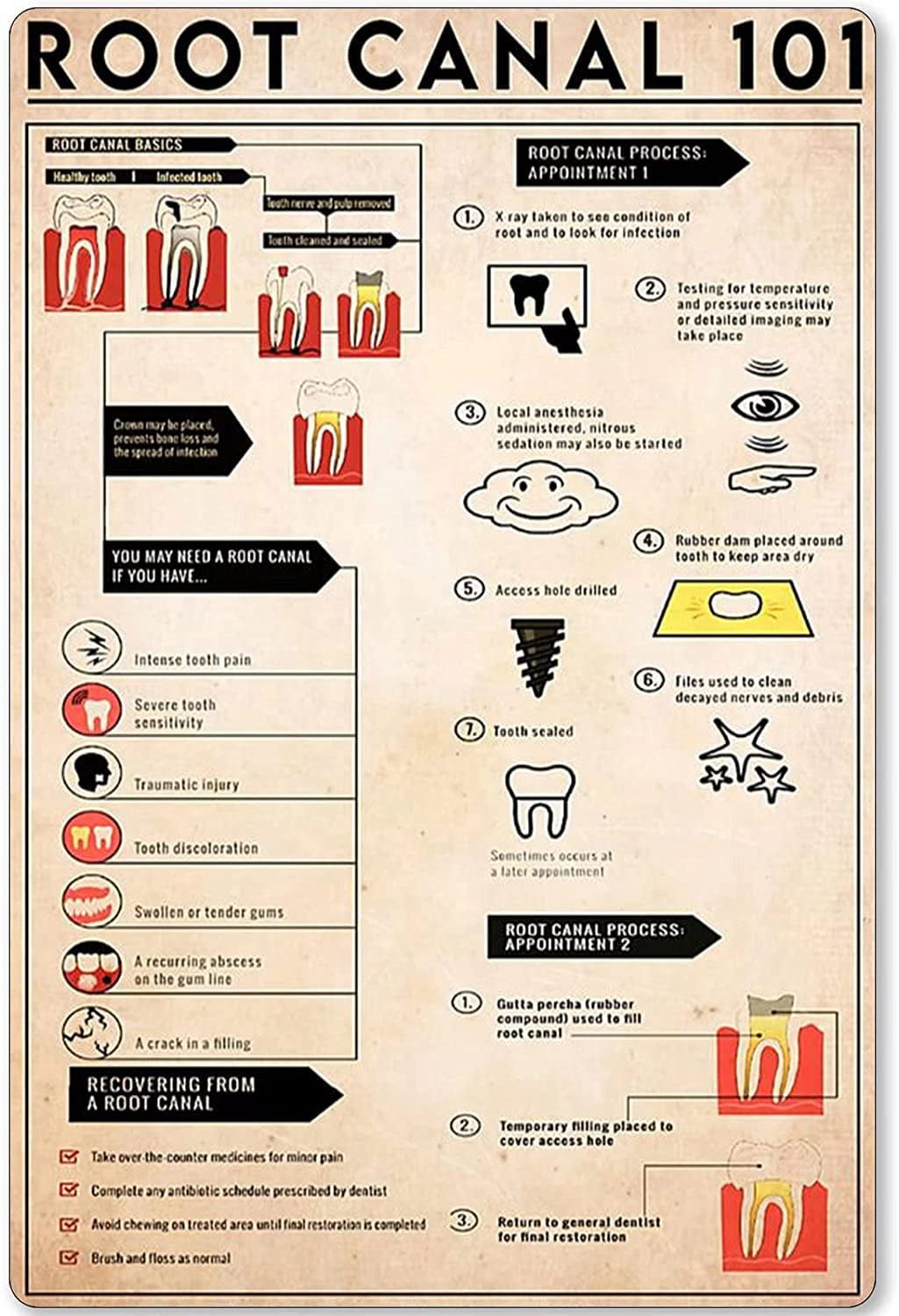 Dentist Knowledge Metal Sign Wall Decor Poster Root Canal 101 Guide ...