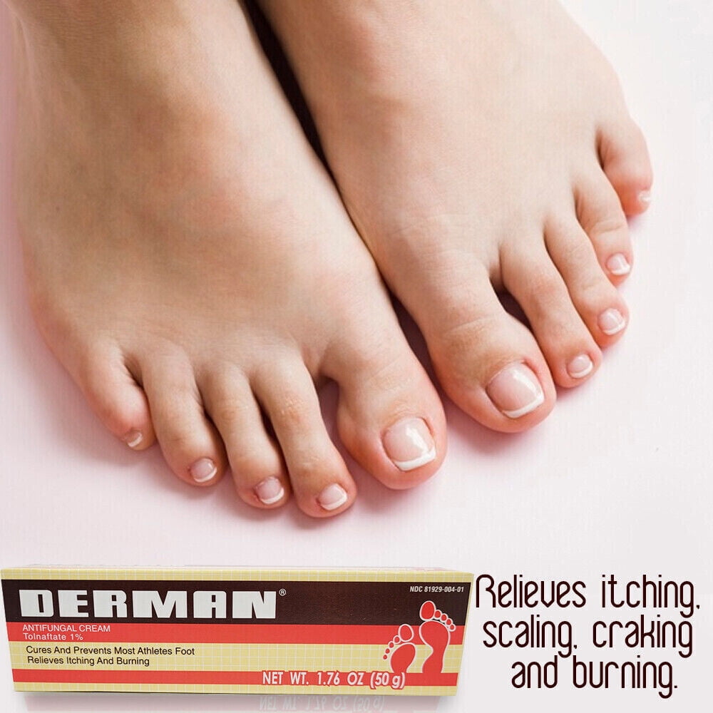 Derman Antifungal Cream for Skin, Ringworm, Jock Itch Treatment, Adults ...