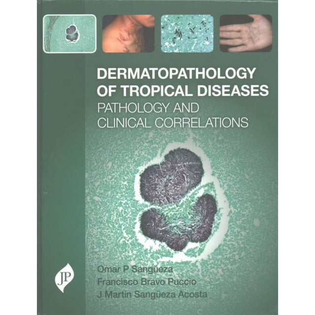 Dermatopathology of Tropical Diseases (Hardcover) - Walmart Business ...