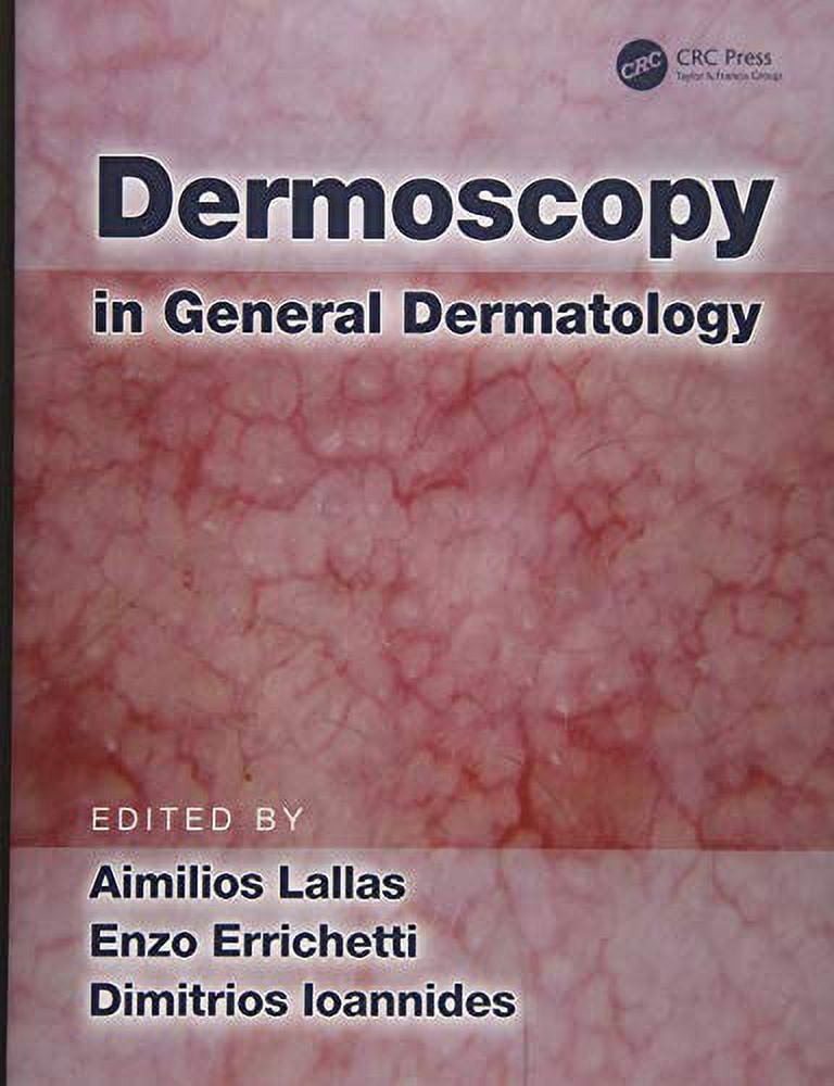 Pre-Owned Dermoscopy in General Dermatology Hardcover - Walmart.com