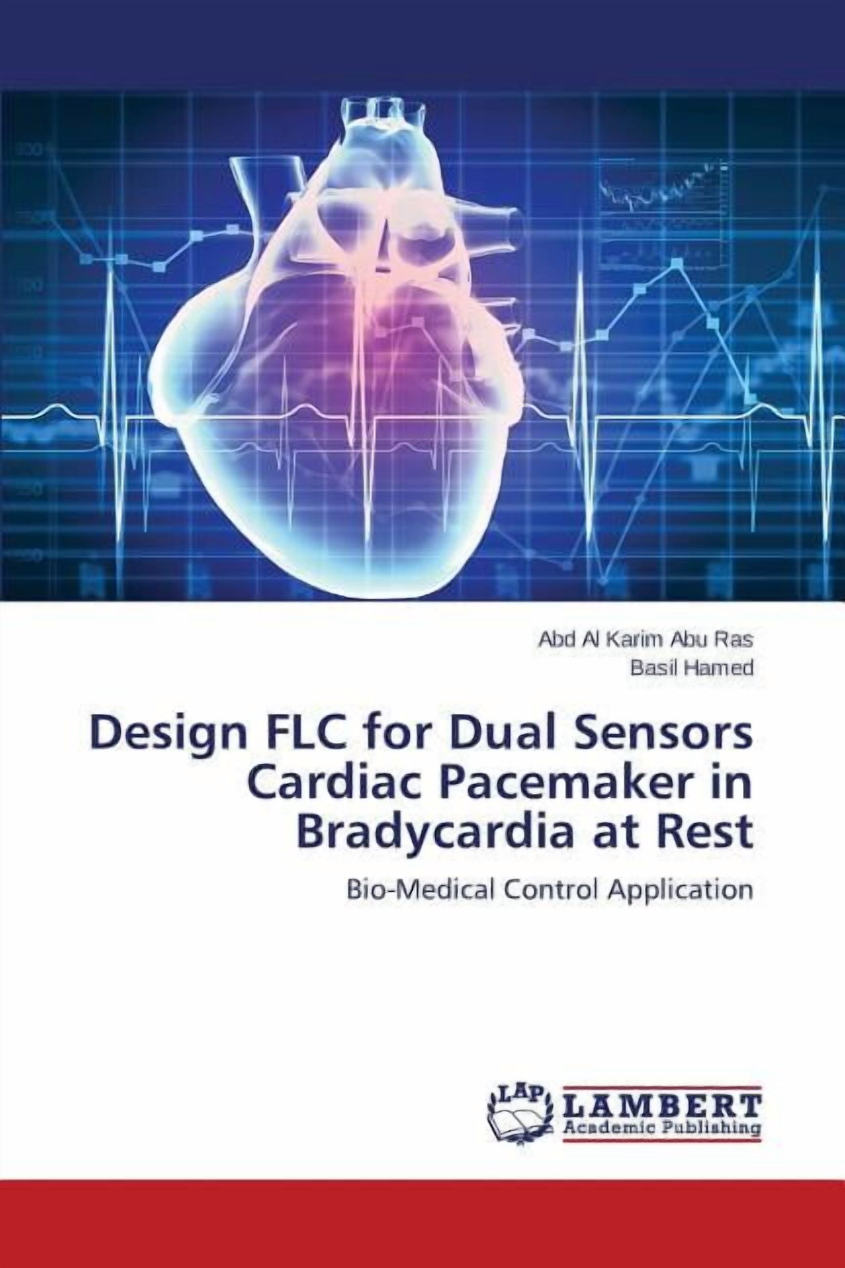 Design FLC for Dual Sensors Cardiac Pacemaker in Bradycardia at Rest ...