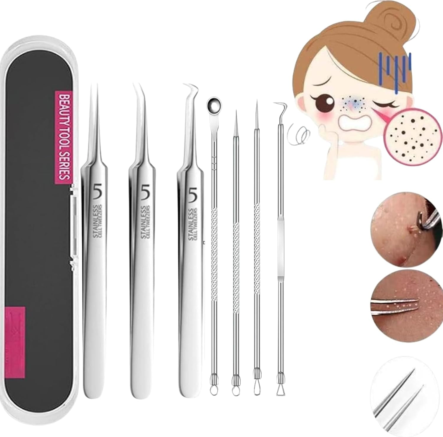 Detroitrain Blackhead Removal,7/8PCS Stainless Steel Blackhead Remover ...