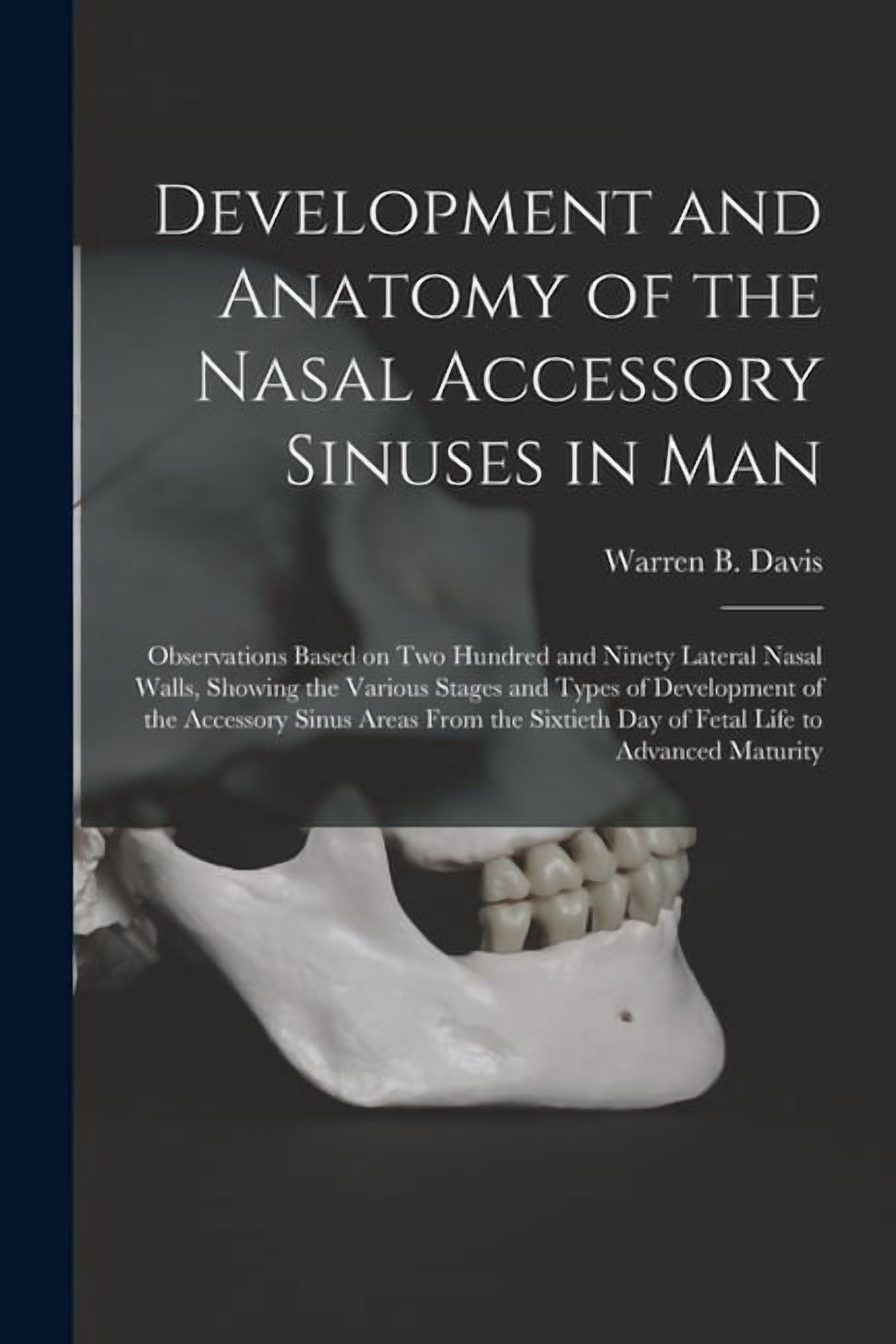 Development and Anatomy of the Nasal Accessory Sinuses in Man ...