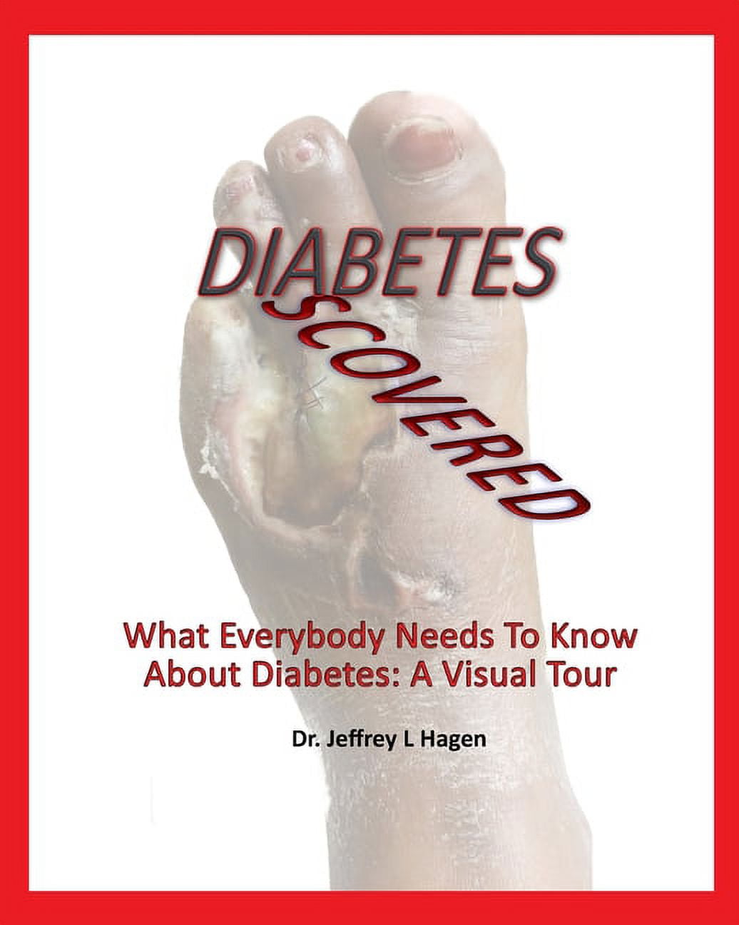 Diabetes Discovered: What Everybody Needs To Know About Diabetes: A ...