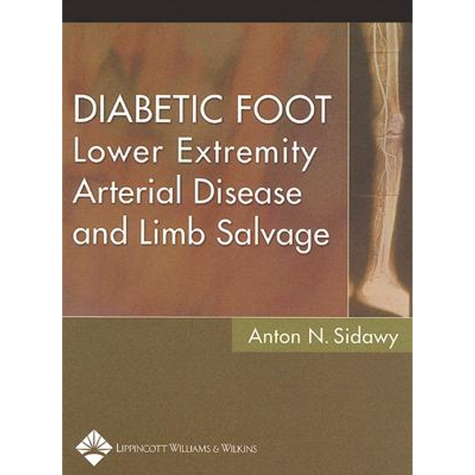 Diabetic Foot : Lower Extremity Arterial Disease and Limb Salvage ...